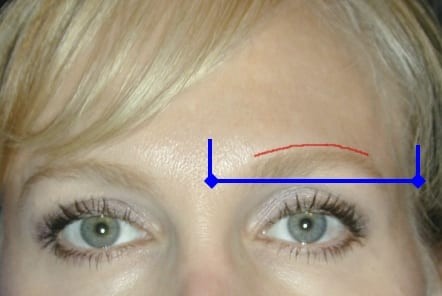 Perfect Proportions: The Meaning of the Boxes – Adam Scheiner MD | Dr ...